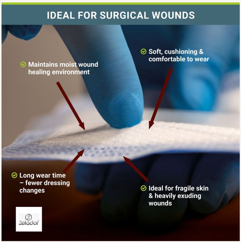 Sorbex Super absorbent dressing – Zelador