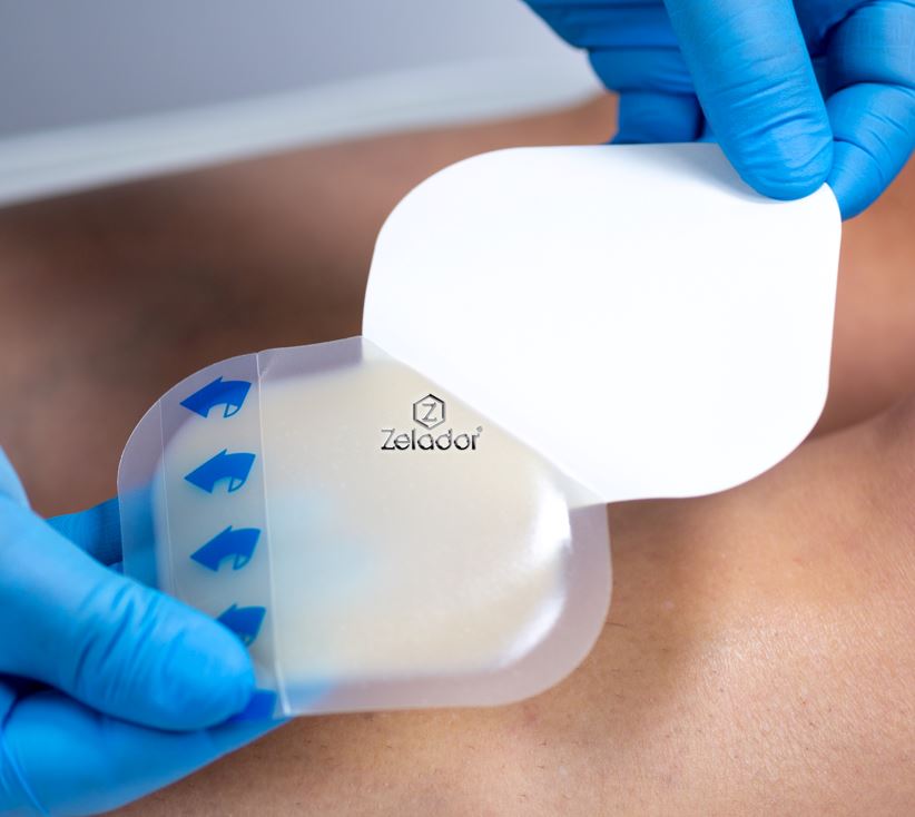 Hydraseal Hydrocolloid Border Dressing – Zelador