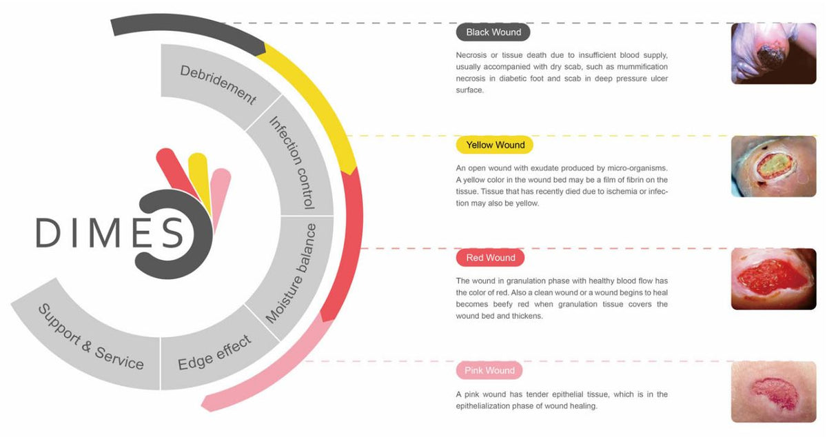 Sorbex Super absorbent dressing – Zelador